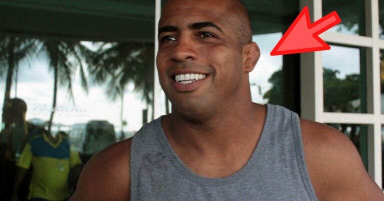 Por qué los luchadores de la UFC tienen orejas raras - Todo Defensa ...